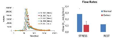 Zacks Small Cap Research - FPMI: Data Continues To Support Utility of ...