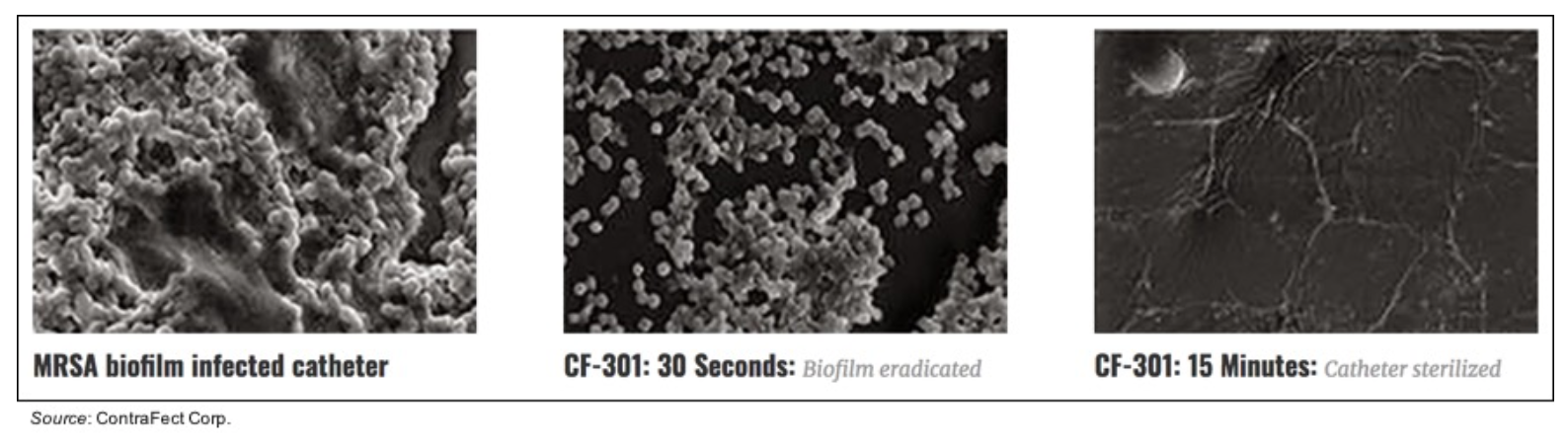 Zacks Small Cap Research - CFRX: Updated Financials Following 1:10 ...