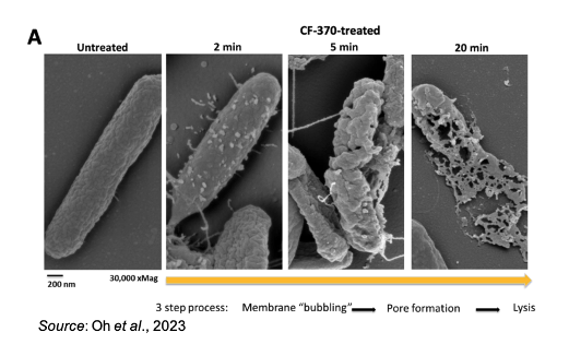 Zacks Small Cap Research - CFRX: First Patient Dosed in Phase 1b/2 ...