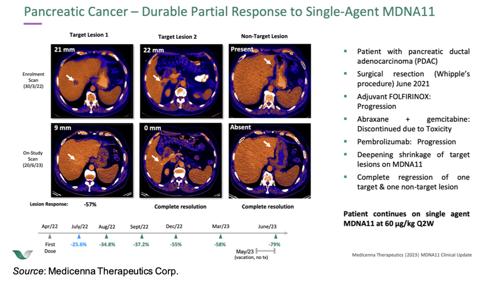 Zacks Small Cap Research - MDNA: Commences Monotherapy Dose Expansion ...
